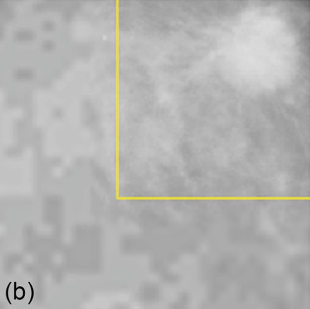 f11-10b-9780128020456